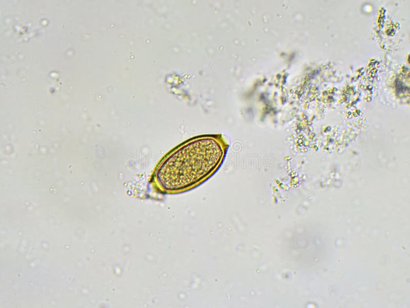 Trichuris trichiura stock photo. Image of fluke, stool - 92761020