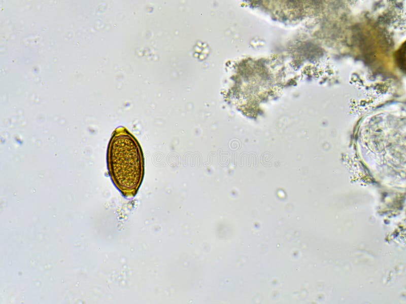 Trichuris trichiura stock image. Image of laboratory - 92761143
