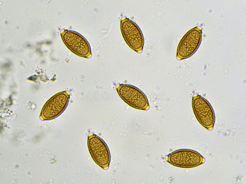 Trichuris Trichiura Under the Microscope. Stock Photo - Image of blood ...