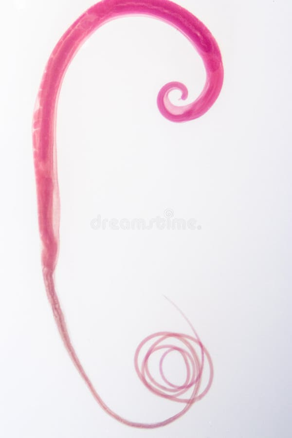Trichuris Trichiura Under the Microscope. Stock Image - Image of ...