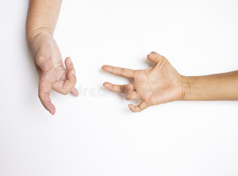 Trigger Finger a Defect in a Tendon Causing a Finger To Jerk or Snap ...