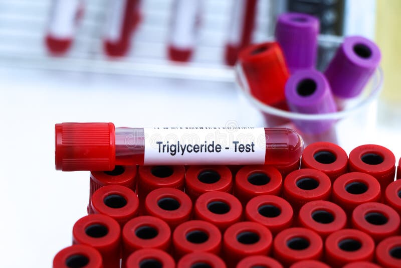 Triglyceride Test To Look for Abnormalities from Blood Stock Photo ...