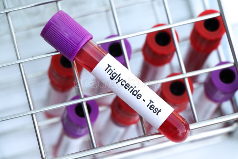 Triglyceride Test To Look for Abnormalities from Blood Stock Photo ...