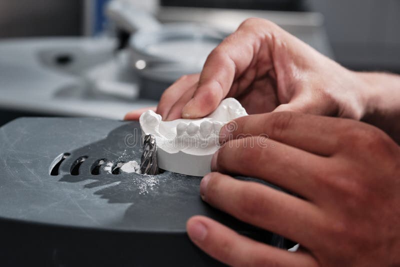 Arch Trimmer Stock Photos - Free & Royalty-Free Stock Photos from ...