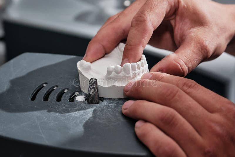 Trim the Dental Arch with a Dental Arch Trimmer. Workplace Dental ...