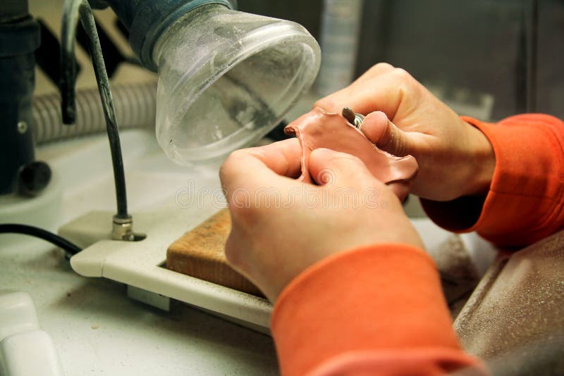 Trimming with Micro Motor Shellac Base Plates Stock Photo - Image of ...