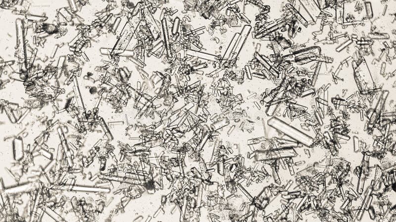 Triple Phosphate Crystals in Human Urine Sediment Stock Photo - Image ...