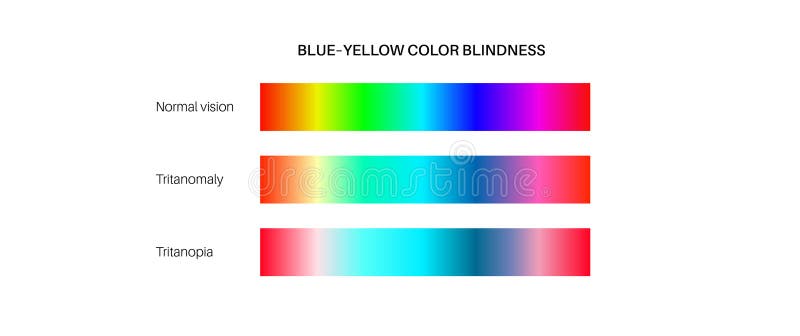 Tritanopia Stock Illustrations – 78 Tritanopia Stock Illustrations ...