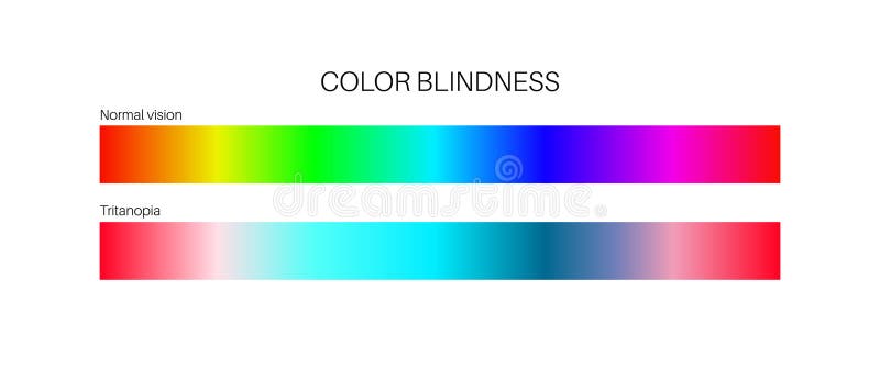 Tritanopia and tritanomaly stock vector. Illustration of infographic ...