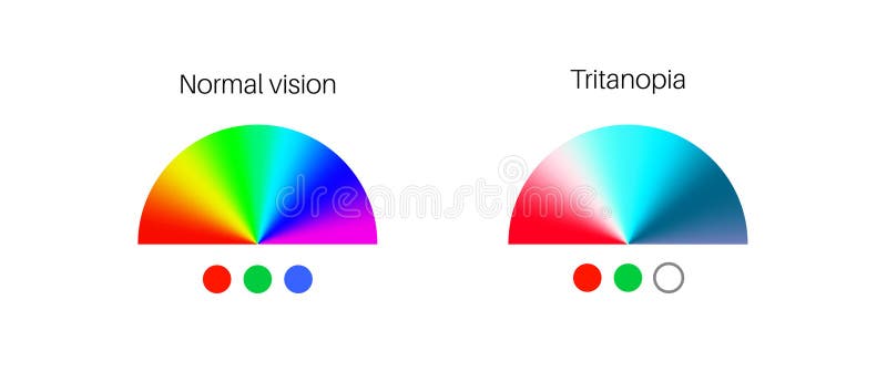 Tritanopia and tritanomaly stock vector. Illustration of colorblind ...