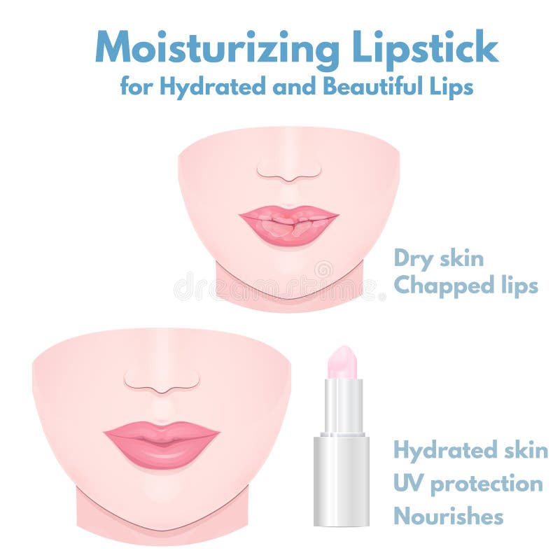 Trockene gebrochene Lippen vektor abbildung. Illustration von mode ...