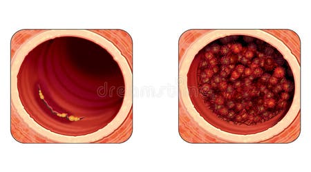 Trombo mural ilustración del vector. Ilustración de ataque - 25621312