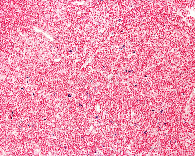 Lymph Node Macrophages Labelled with Trypan Blue Stock Photo - Image of ...