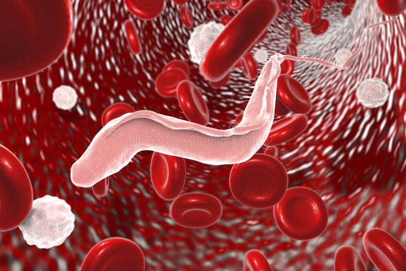 Menschliche Parasiten stock abbildung. Illustration von realistisch ...