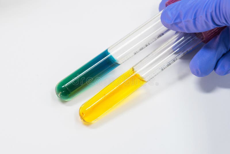 TSI Positive and Negative for Biochem Test for Bacteria; Bioch Stock ...