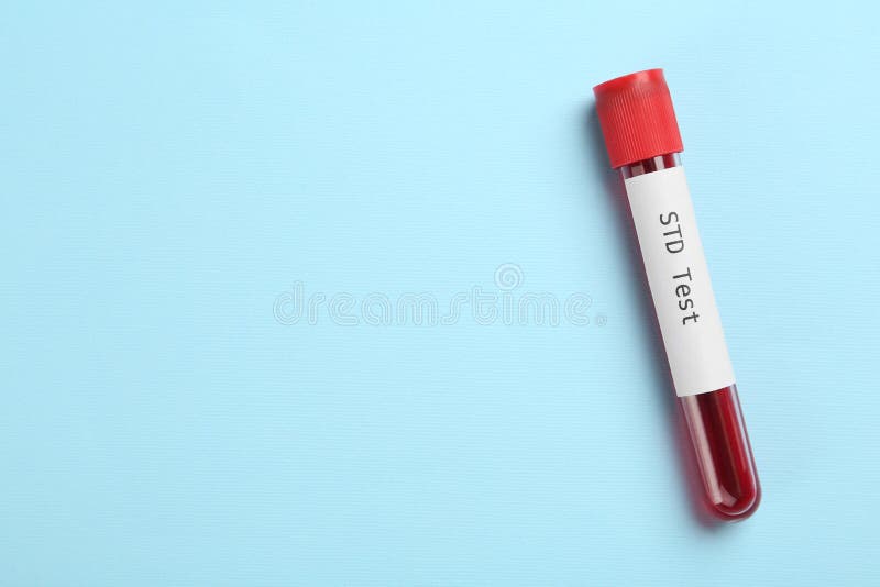 Chlamydia Lab Stock Photos - Free & Royalty-Free Stock Photos from ...