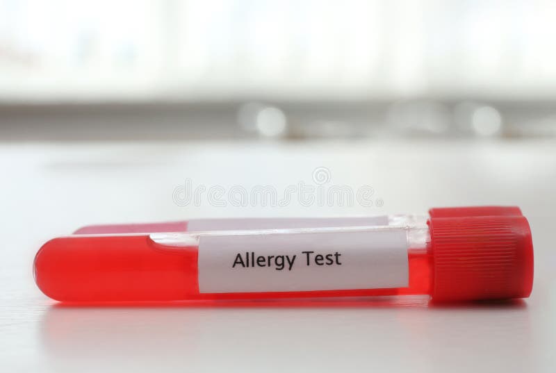 Tube with Label ALLERGY TEST on White Stock Image - Image of ...