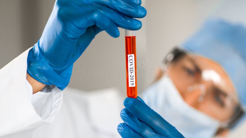 Tube with the Tested Test in the Hands of a Laboratory Assistant ...