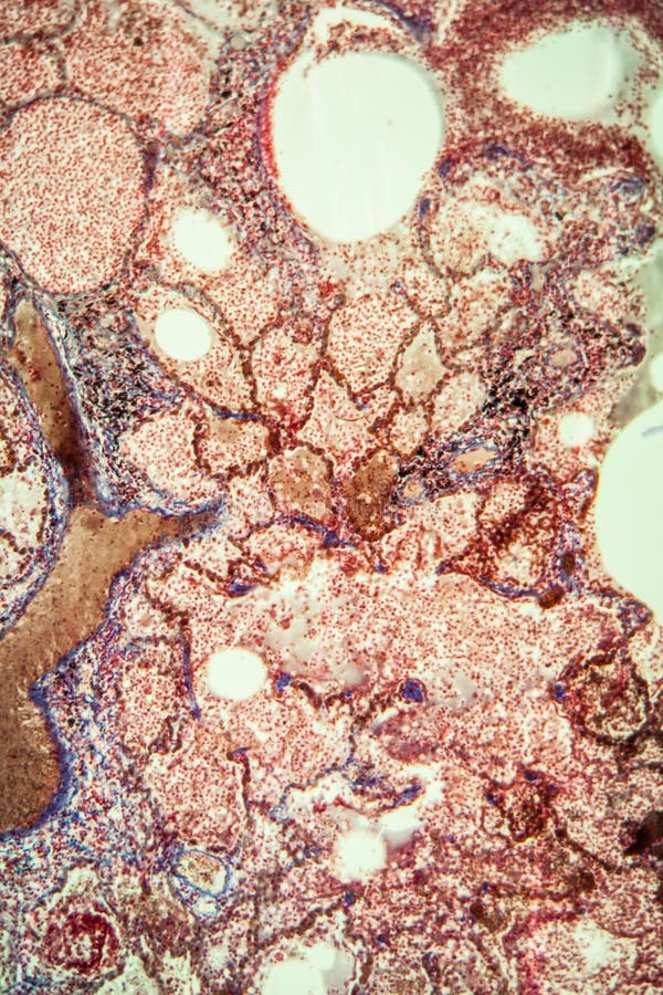 Tuberculosis tissue stock photo. Image of cells, science - 196727344