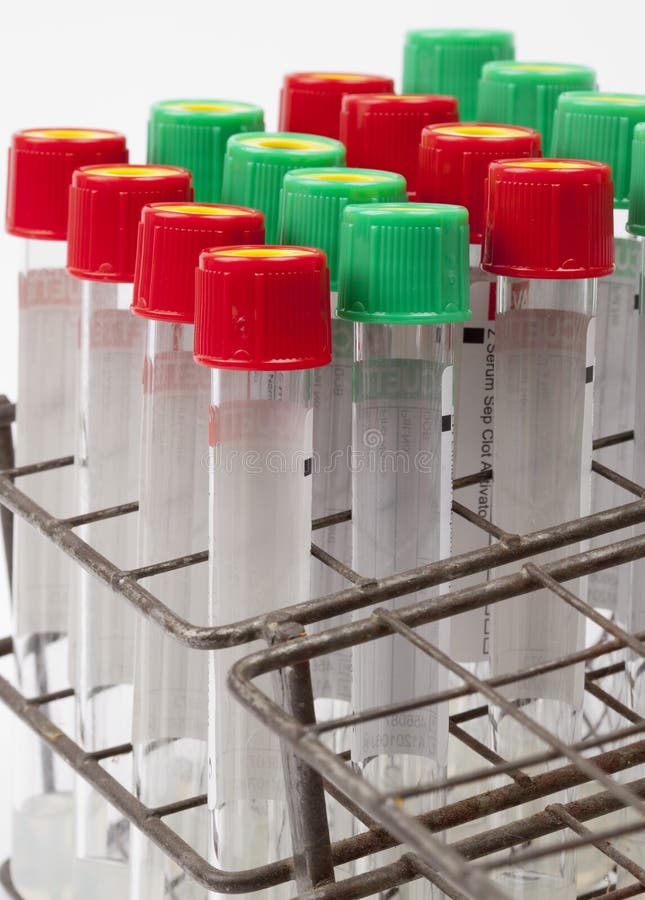 Blood tubes stock photo. Image of medical, chemical, research - 74258