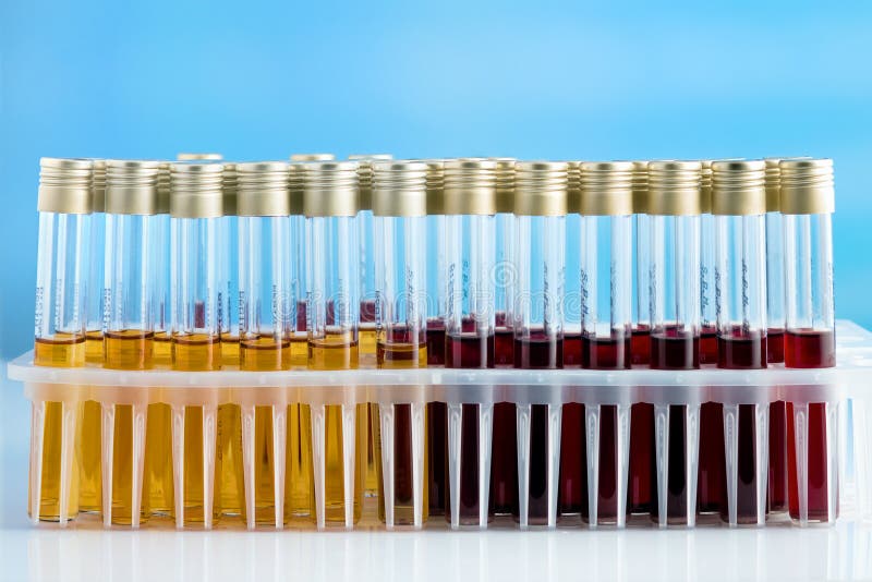 Tubes Avec Le Milieu Liquide Photo stock - Image du medias, chimie ...