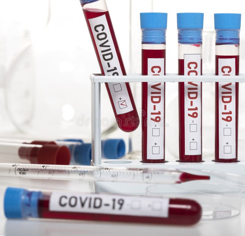 Tubes of Biological Sample Contaminated by Coronavirus with Label Covid ...