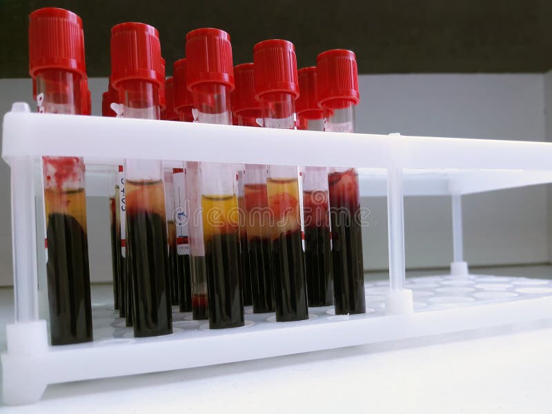 Tubes of Blood Sample for Lab Testing Stock Image - Image of ...