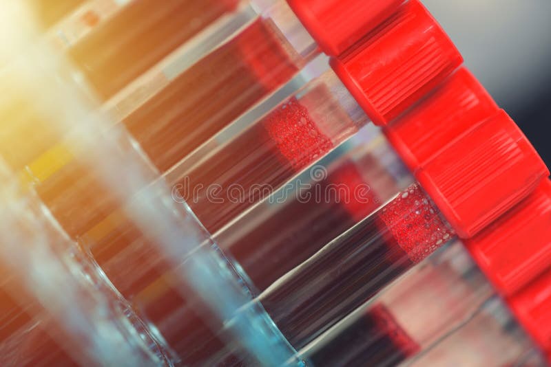 Tubes of Blood Sample for Testing. Medical Equipment Stock Image ...