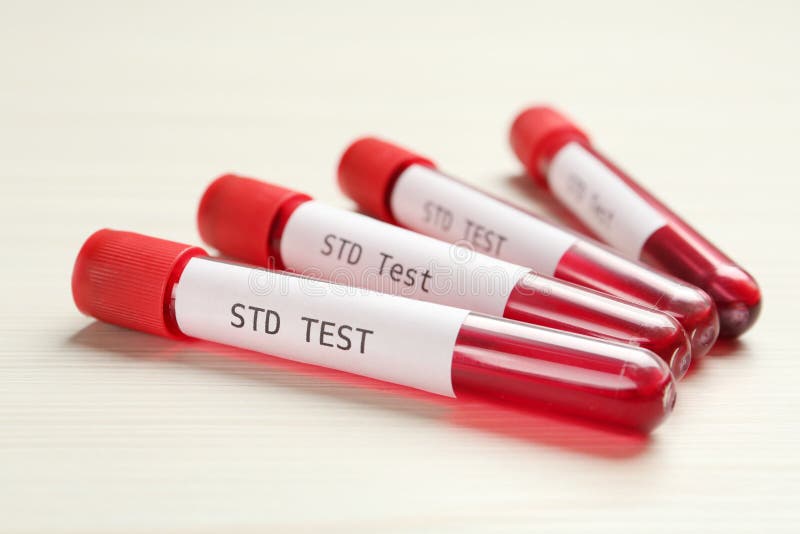 Tubes with Blood Samples and Labels STD Test on White Wooden Table ...
