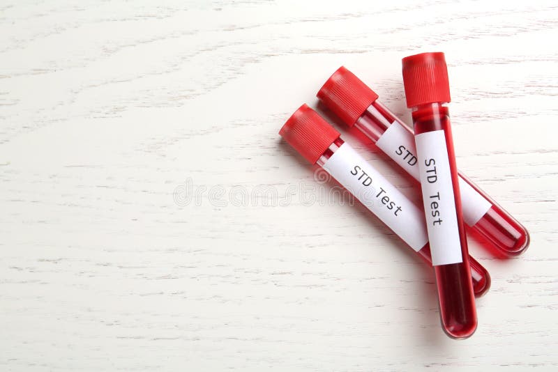Tubes with Blood Samples and Labels STD Test on White Wooden Table ...