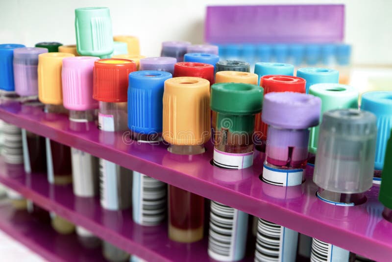 Tubes with blood on a tray stock image. Image of healthcare - 71691219