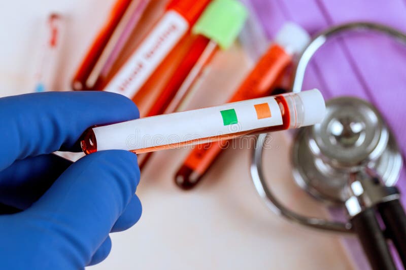 Tubes Containing Blood Samples for Use in a Medical Laboratory for ...