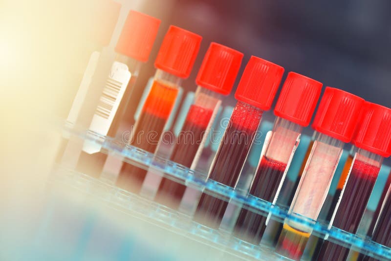 Tubes De Prise De Sang Pour L'essai Mat?riel M?dical Image stock - Image du biochimie, soin ...