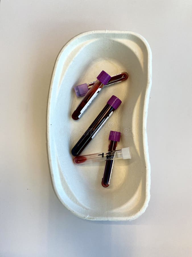 Tubes with Peripheral Blood Samples after Analysis. Stock Photo - Image ...