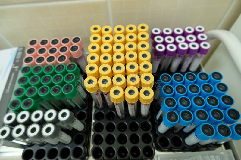 Tubes Prepared for a Medical Lab Study Editorial Photography - Image of ...