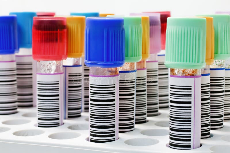 Tubes in a rack stock photo. Image of experiment, examination - 22259860