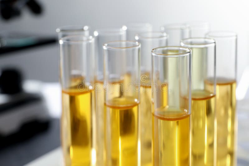 Tubes with Urine Samples for Analysis in Laboratory, Closeup Stock ...