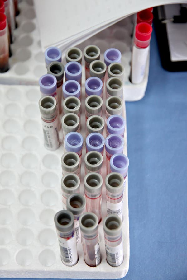 Tubes Using Blood Samples To Be Examined. Stock Photo - Image of ...