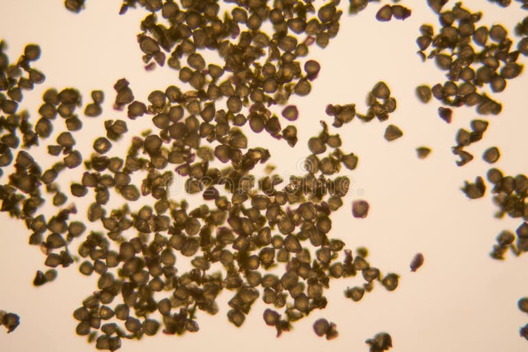 Tulip Pollen at the Microscope Stock Image - Image of microscope, soft ...