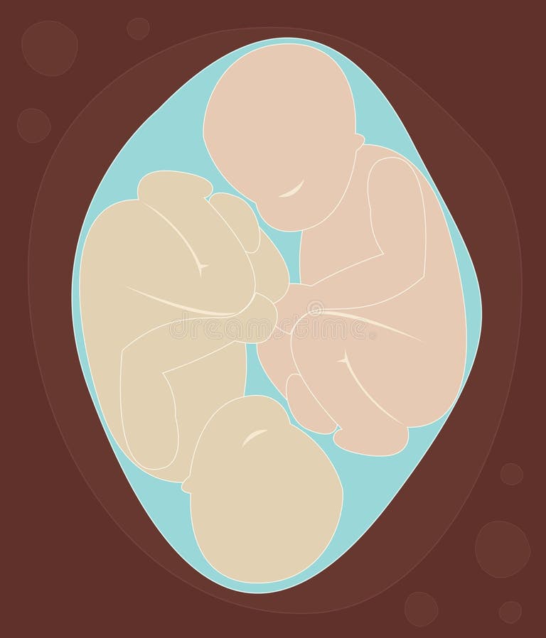 Twins Womb Stock Illustrations – 199 Twins Womb Stock Illustrations ...