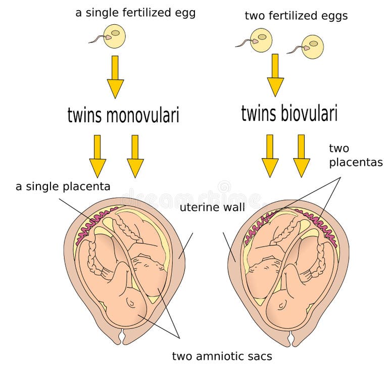 Twins Embryo Stock Illustrations – 218 Twins Embryo Stock Illustrations ...