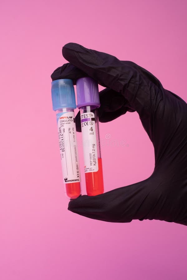 3,955 Blood Samples Stock Photos - Free & Royalty-Free Stock Photos ...