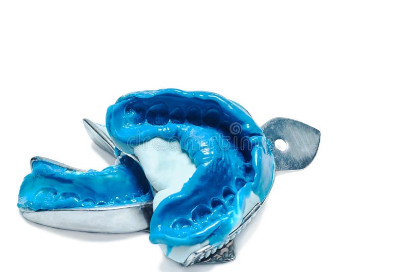 Two Dental Impressions On A White Background With Copy Space. The ...