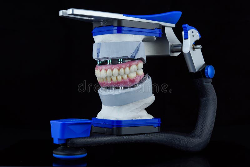 Two Dental Prostheses Made of Ceramic with a Pink Gum, on the Dental ...