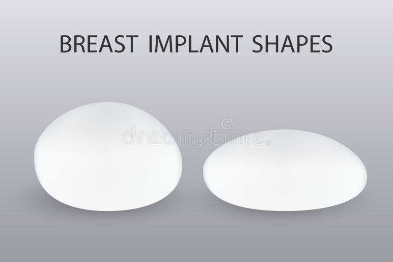 Two Different Types of Silicone Breast Implants. Stock Vector ...