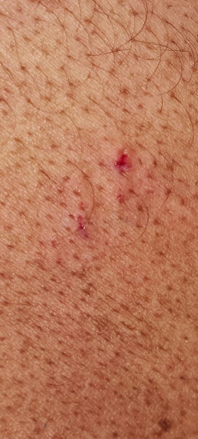 How To Treat A Small Dog Bite