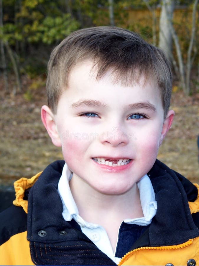 Two Front Teeth stock image. Image of young, school, smiling - 2059681