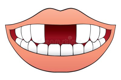 Missing Tooth Cartoon Stock Illustrations – 269 Missing Tooth Cartoon ...
