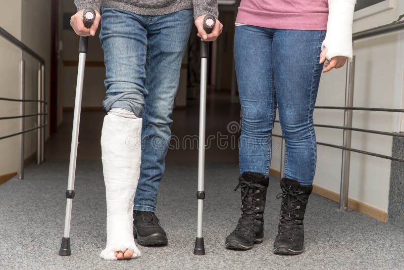 Two persons with casts stock image. Image of accident - 87062715