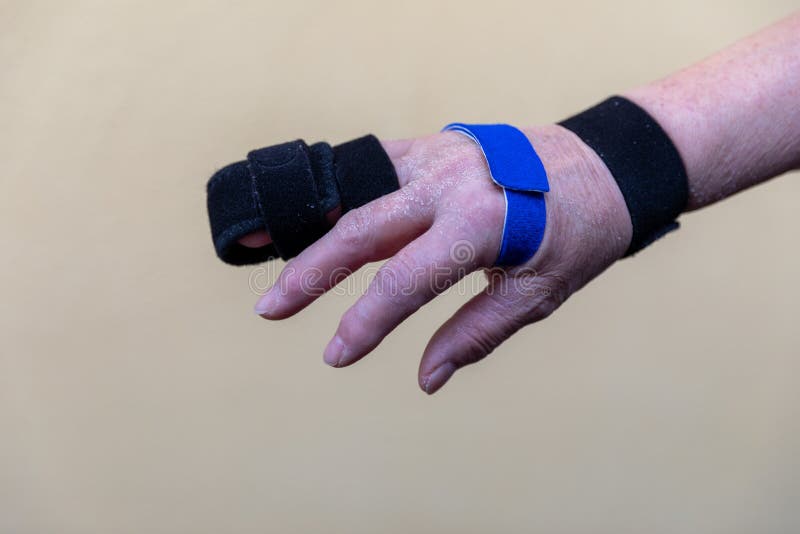 Two Sided Finger Splint with Two Hook and Loop Straps on a Broken ...